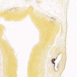 High Resolution Image Viewer :: Allen Brain Atlas: Developing Mouse Brain