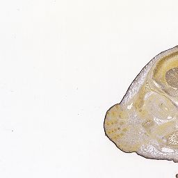 High Resolution Image Viewer :: Allen Brain Atlas: Developing Mouse Brain