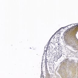 High Resolution Image Viewer :: Allen Brain Atlas: Developing Mouse Brain