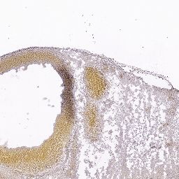 High Resolution Image Viewer :: Allen Brain Atlas: Developing Mouse Brain